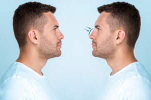 Nose Bridge Issues: Why They Occur & How to Treat Them - carla diab